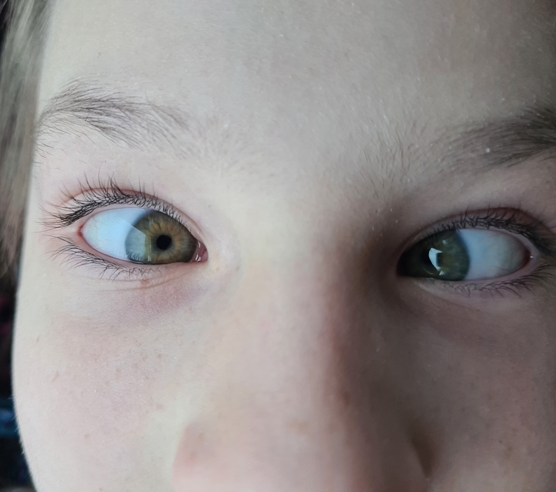 Functionally Assessing And Treating Visual Processing Visual Perception And Visual Motor